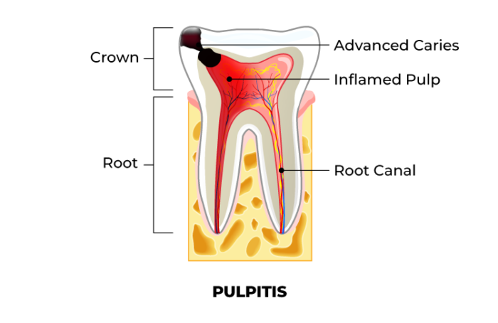 Capital Endodontics | Endodontics