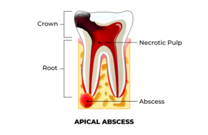 Capital Endodontics | Endodontics